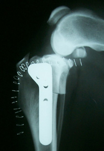 Cruciate Repair Methods in Harvard, MA | ProFormance Canine Inc.